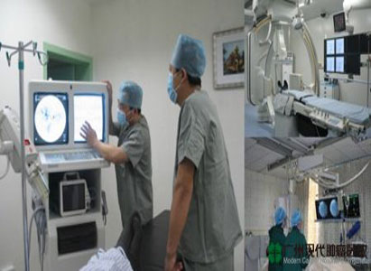 Terapi Kanker Embolisasi Arteri Intercurrent - Kanker “mati kelaparan ...