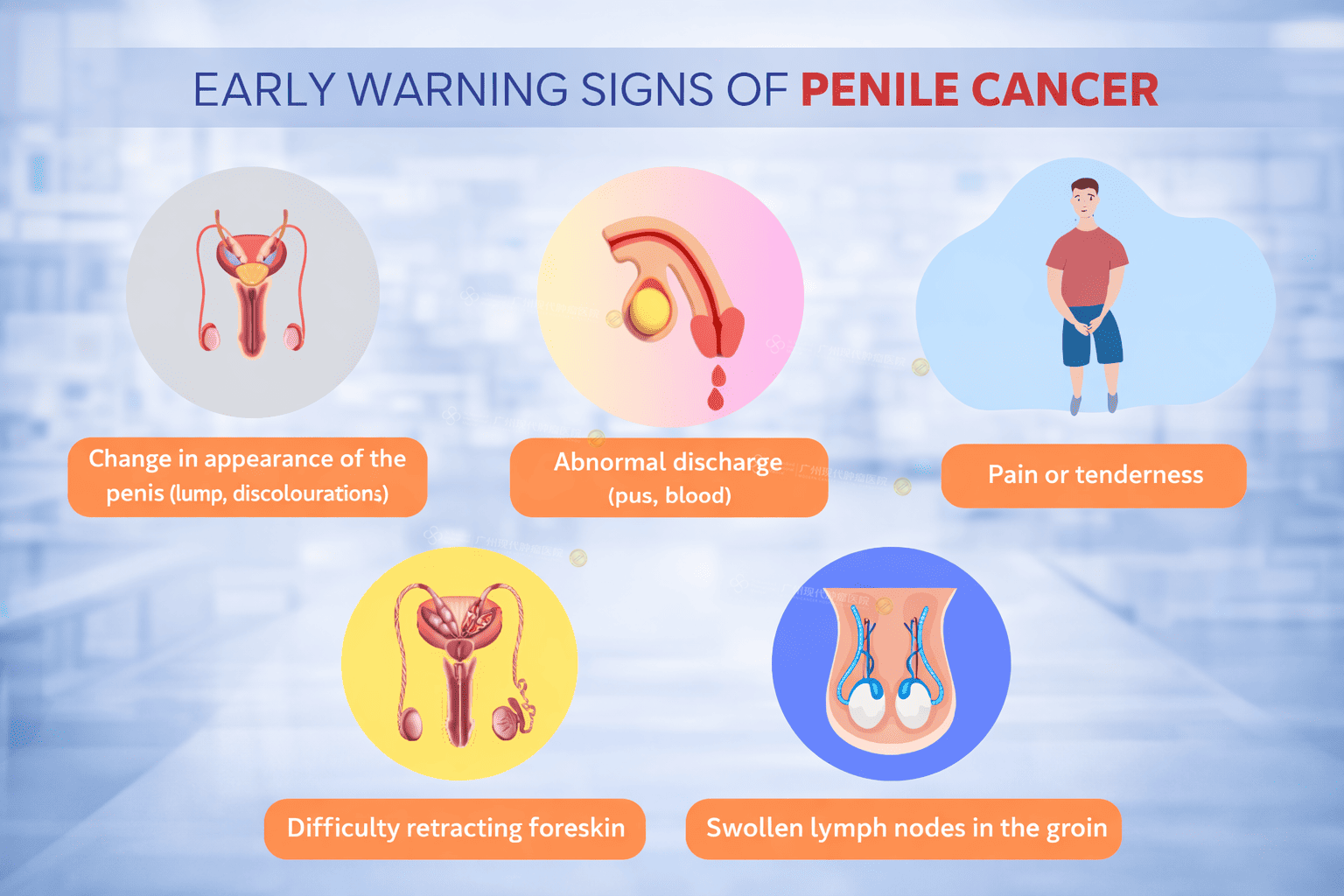 Penile Cancer St Stamford Modern Cancer Hospital Guangzhou Penile Cancer St Stamford Modern Cancer Hospital Guangzhou